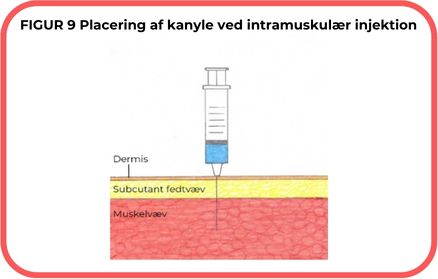 Intramuskulære injektionsteknikker -Sikker og evidensbaseret praksis i ...